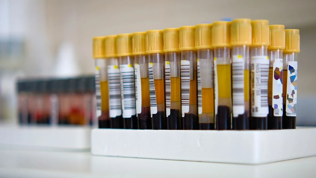 Molecular Psychiatry: изменение белка SHMOOSE увеличивает риск развития ...